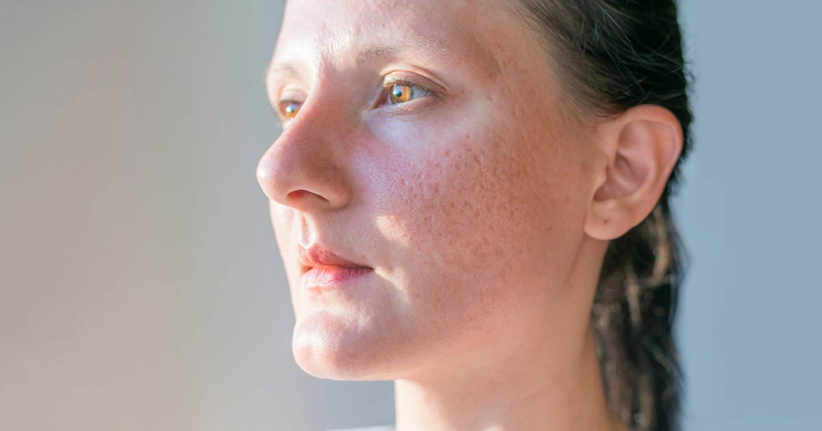 Talgdrüsen und ihr Einfluss auf die Hautgesundheit